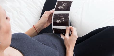 Sacrococcygeal Teratoma Tumor Umum Yang Bisa Menyerang Janin