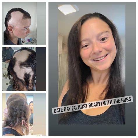 Jon Kekoa On Linkedin If You Are Not Activated You Need To Start