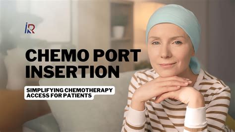 Chemo Port Insertion Simplifying Chemotherapy Access For Patients