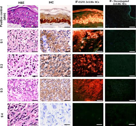 Egfr Labeling On Ffpe Tissue Samples Using Egfr Znsmn Ncs With Hande