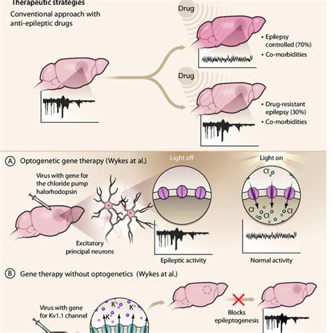 Gene Therapy For Treating Epilepsy Top Panel Acquired Epilepsies In