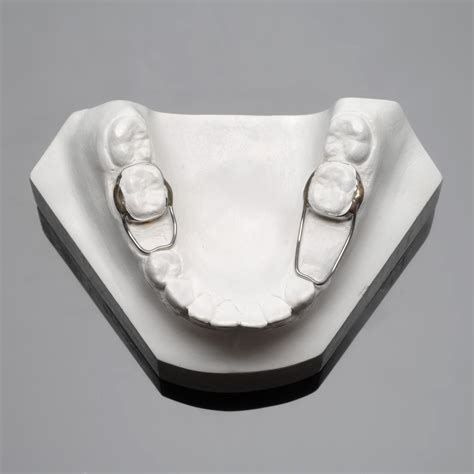 Orthodontic Appliances Palate Expander Philadelphia Orthodontics