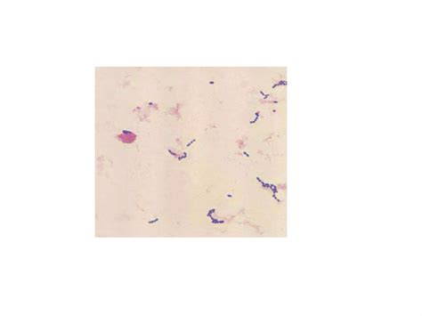 Streptococcus 2 Pptx