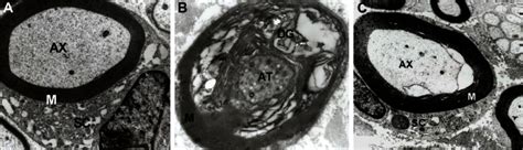 Electron Micrographs Of Sciatic Nerve Transverse Sections Of B