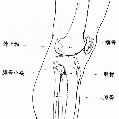 右股骨髁间粉碎性骨折左髌骨粉碎性骨折被鉴定为七级工伤