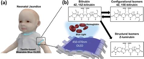 Concept Of The Textile‐based Wearable Blue Oled‐based Neonatal Jaundice
