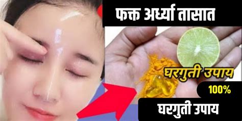चेहऱ्यावरील काळे डाग काळसर चेहरा फक्त मोजून अर्ध्या तासात झटपट गोरा