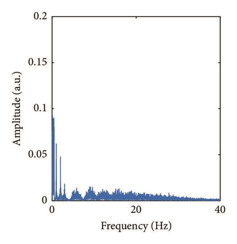 A Exemplary Ecg Signal Corrupted By An Arbitrary Realization Of The Download Scientific