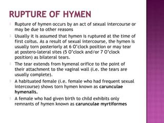 Virginity Sexual Offenses And Ppt