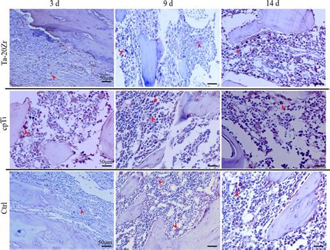 Representative Images Showing Ihc Staining For Cd68 On Days 3 9 And 14