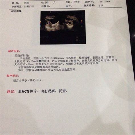 药流要住院吗药流要多长时间 随意云