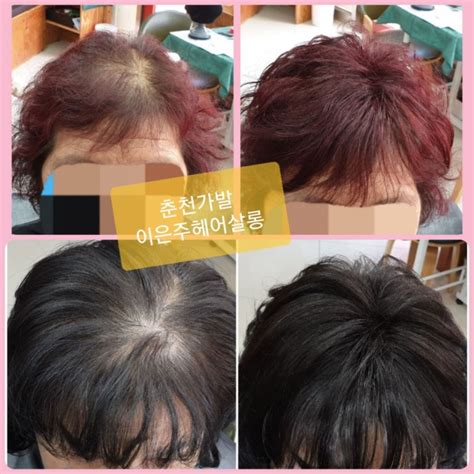 춘천부분가발 정수리가발 흉터가발 탑가발 앞머리가발 수제가발 맞춤가발 여성갱년기탈모 네이버 블로그