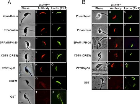 Localization At Acrosomal Proteins Zonadhesin Proacrosin