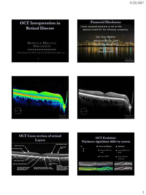 212 Oct Interpretation In Retinal Disease 1hr Monterey 2017 Ho