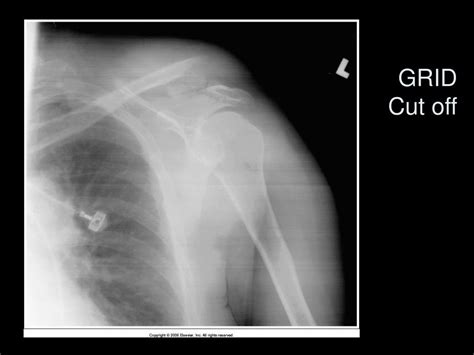 What Is Grid Cut Off At Michael Goodwin Blog