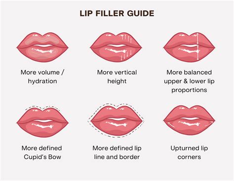 Lip Fillers Your Guide To A Perfect Pout U Med Spa Plano And Frisco