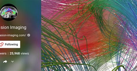 share your diffusion imaging news diffusion imaging introduction
