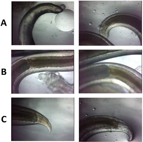 Light Assisted Microscopic Observation Of The Nematodes Nematode Has Download Scientific