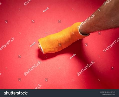 Fibreglass Cast Waterproof At Joe Alvarez Blog