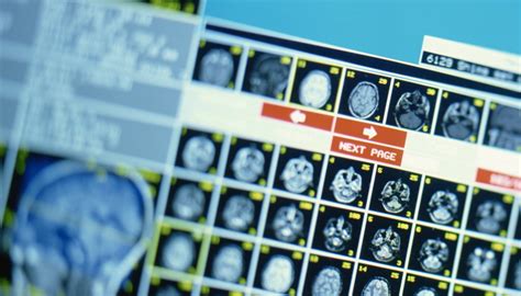 Babes That Offer Radiology As A Major The Classroom