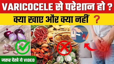 Best Ayurvedic Treatment For Varicocele Dr Health Experts