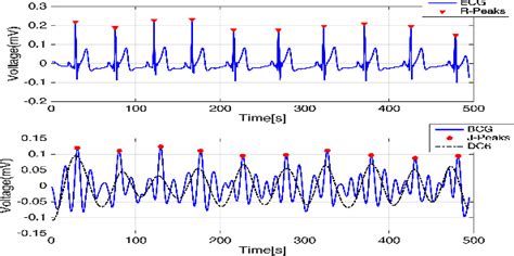 Figure 6 From Sensor Data Quality Processing For Vital Signs With
