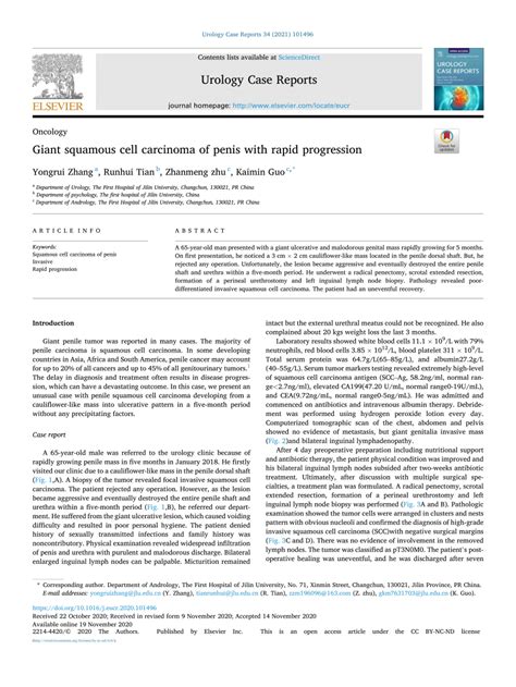 Pdf Giant Squamous Cell Carcinoma Of Penis With Rapid Progression