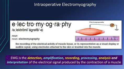 Intraoperative Electromyography Emg Pptx