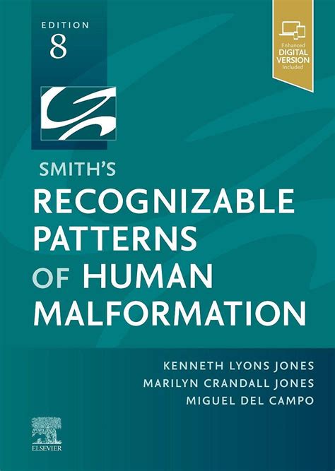 Smiths Recognizable Patterns Of Human Malformation Expert Consult