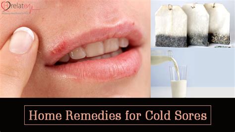 Home Remedies For Cold Sores Fever Blister Se Nijad Paye
