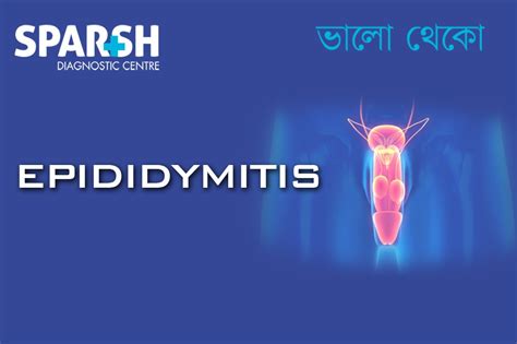 Epididymitis Sparsh Diagnostic Center