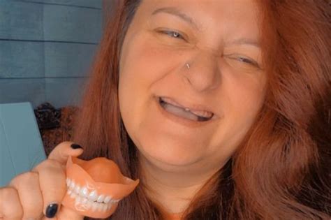 I Had A Gummy Smile With No Teeth After 2300 Dentures I Can Smile Normally Mirror Online