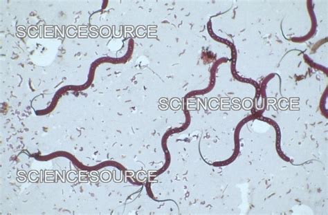 Spirillum Volutans Under A Microscope Stock Image Science Source Images