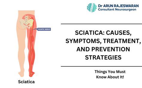 Sciatica Causes Symptoms Treatment And Prevention Strategies