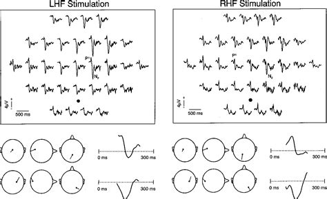 Figure 4 From The Development Of Hemispheric Asymmetry In Human Motion Veps Semantic Scholar
