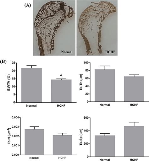 Evaluation Of Structural Bone Histomorphometric Parameters In The Two