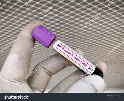 Blood Sample Tube Hormone Amh Test Stock Photo 2027443121 Shutterstock