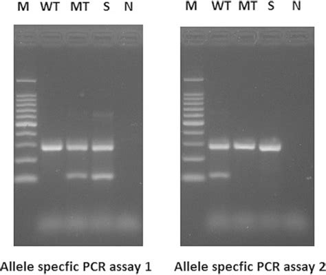 Direct Detection Of Erythromycin Resistant Bordetella Pertussis In Clinical Specimens By Pcr Pmc