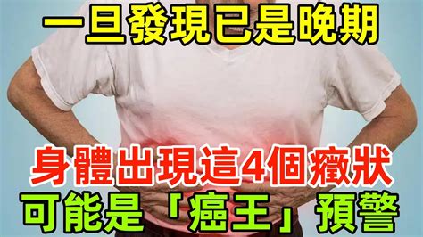 一旦發現已是晚期？身體出現這4個癥狀，可能是「癌王」預警 健康常識 養生保健 健康 健康飲食 Youtube