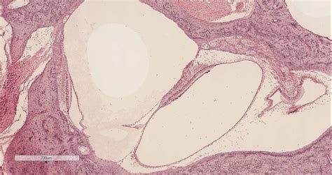 Ear Histology Part 2 Diagram Quizlet