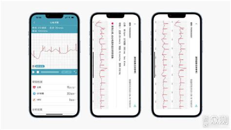 Dido G28s心电血压手表：全能健康监测助手原创新浪众测
