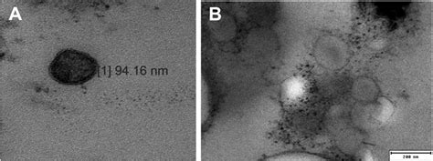 Abbreviations Cad Coronary Artery Disease Cryo Tem Cryogenic