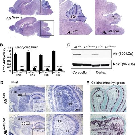 Atr Deficiency Leads To Dna Damage Accumulation And Increased Apoptosis