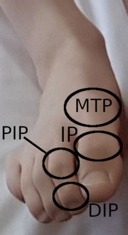 Interphalangeal Joints Of The Foot Wikipedia