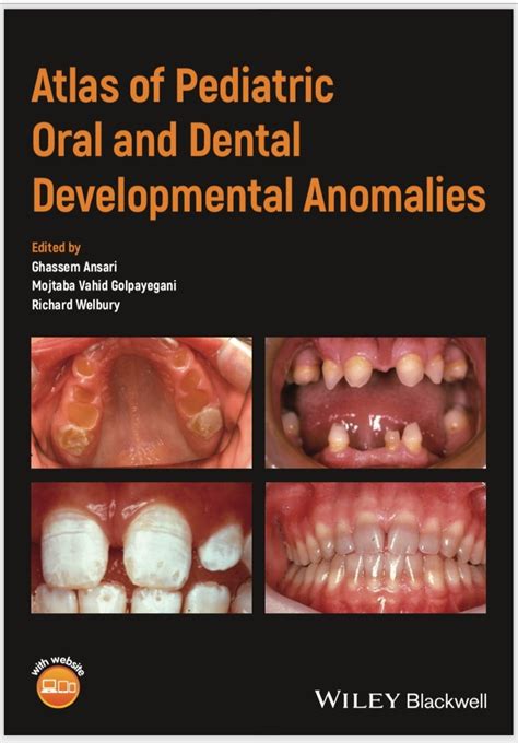 Pdf Atlas Of Pediatric Oral And Dental Developmental Anomalies