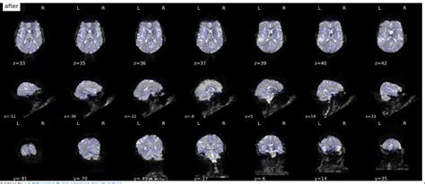 Fmriprep Error Reference Passed Is Not Aligned With Spline Grids Software Support Neurostars