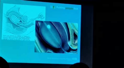 [video] Susan Perry Posted On Linkedin