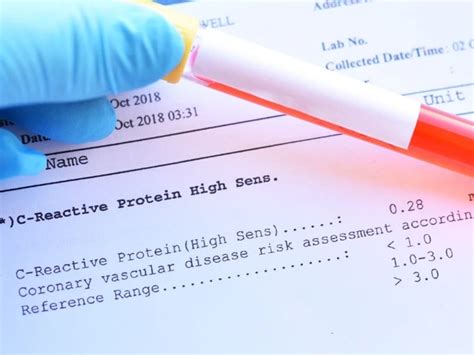 C Reactive Protein Test