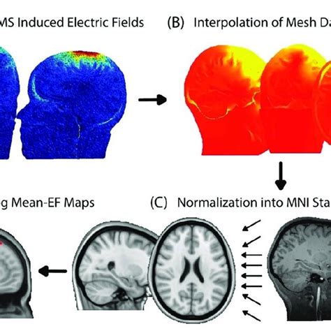 Tms Induced Electric Field Distribution Processing And Visualization Download Scientific