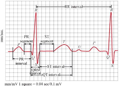 Significant Features Of One Beat Ecg Signal Download Scientific Diagram